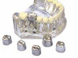 Directa TIN Crowns #7U Directa Tin Temporary Crown Refills, Offers | Net32
