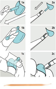 BlueView Matrices Transparent Cervical Matrices Placement Instrument ...