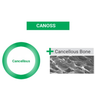 cancellous bone chips