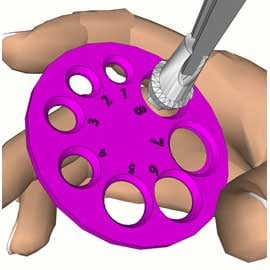 G-Cuff(TM) tissue retraction system G-Cuff Refill - Abutment Measuring ...
