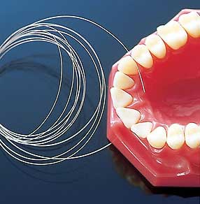 Diamond Floss Regular. Flexible, reusable "floss", Removes resin ...