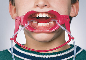 Dry-field Isolation | Net32