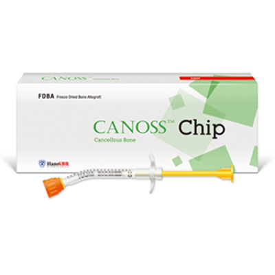 cancellous bone chips