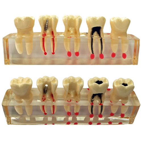 BesQual Study Models - BQ-M3. Transparent Teeth Model - Molar study ...